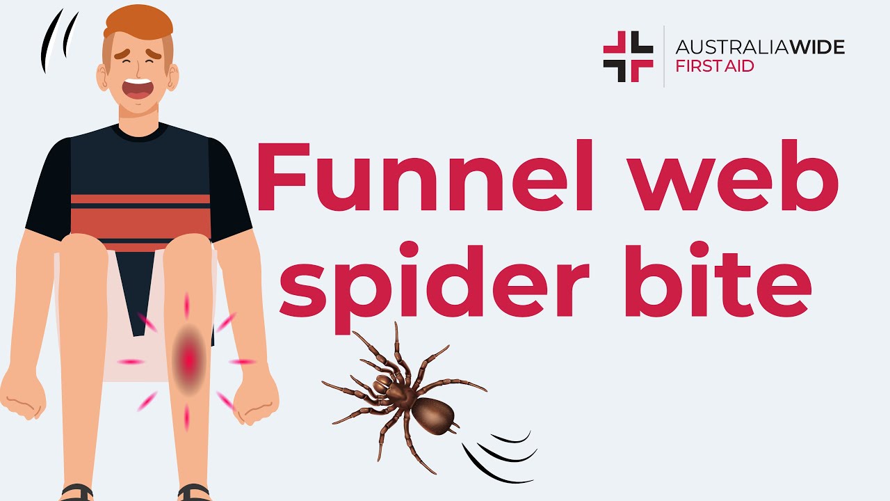 Understand deadliest spider:Sydney funnel-web spider - Spider Pedia